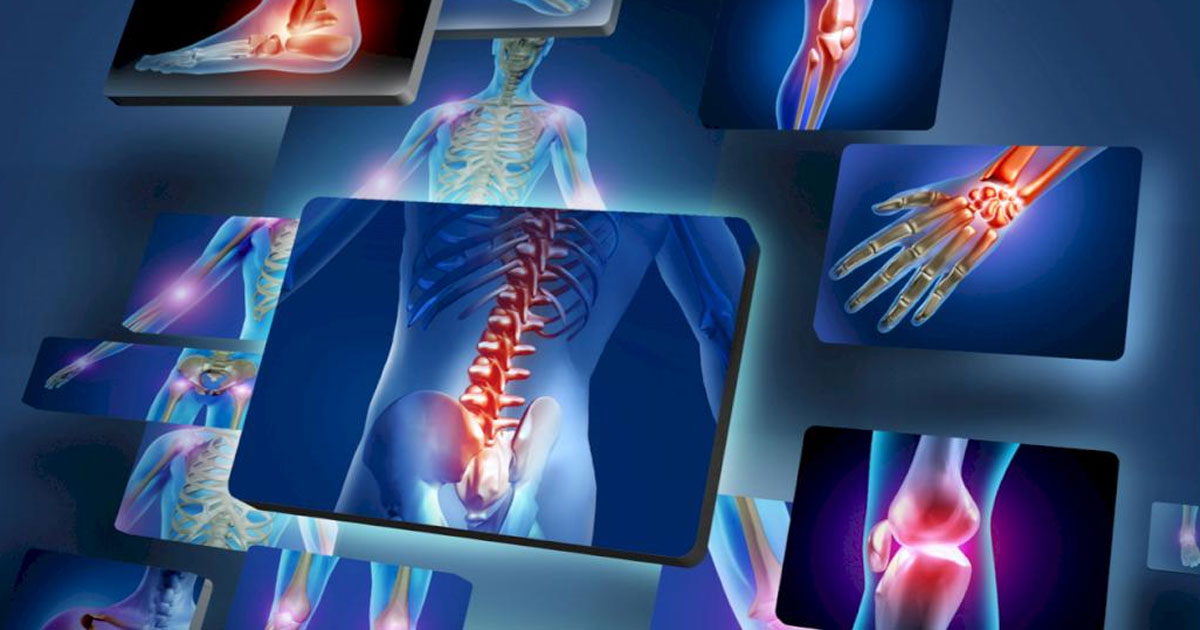 Dureri articulare: 15 alimente care ajută la prevenirea durerilor ...