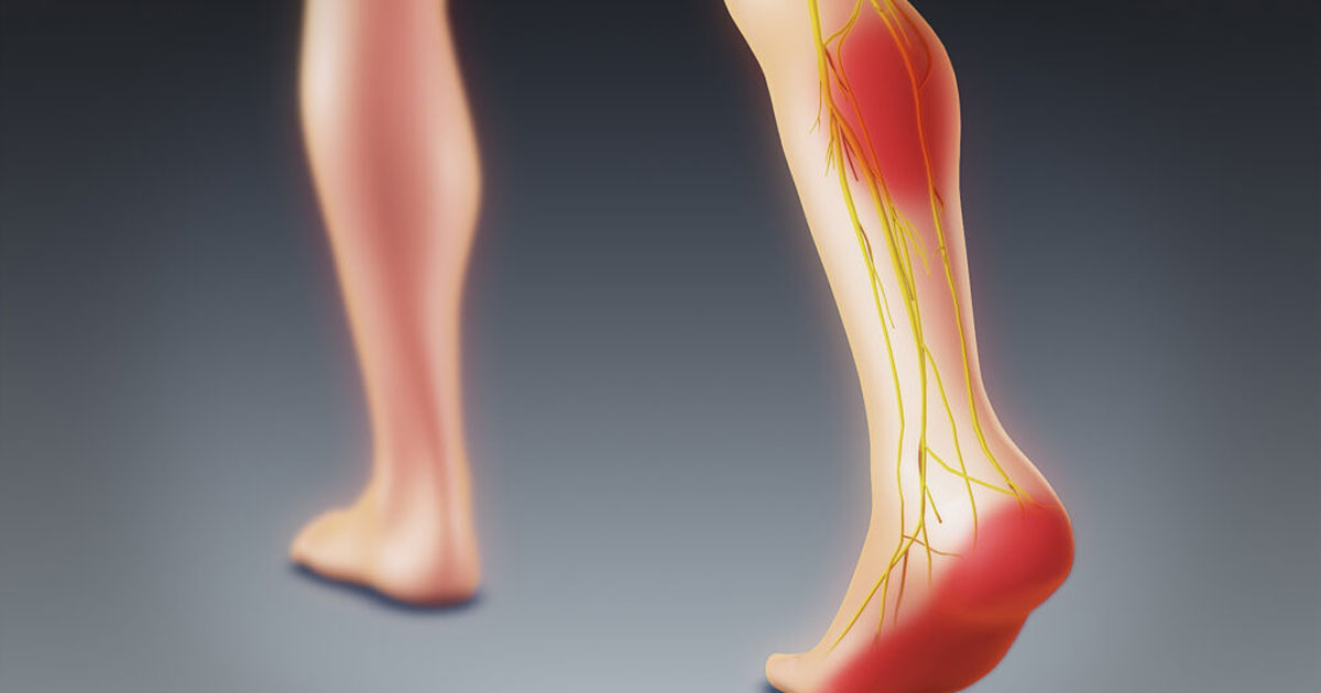 Doar 2 exerciții, iar nervul sciatic nu vă va mai deranja